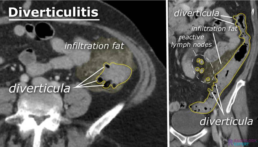 Ct Abdomen General